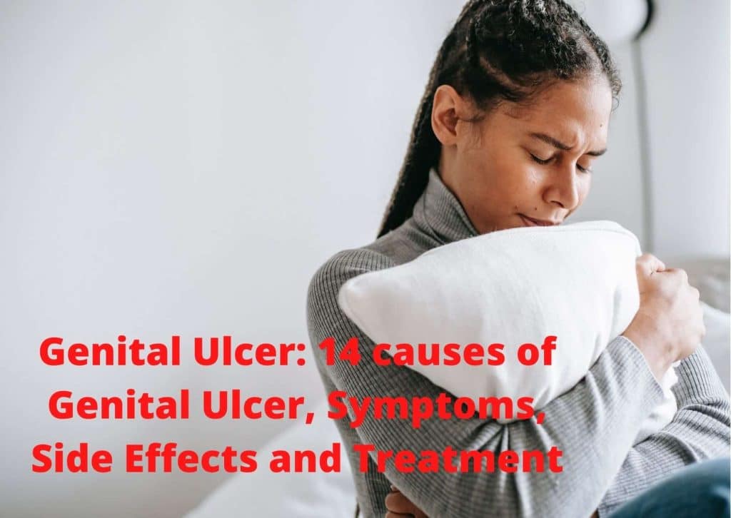 Genital Ulcer 14 Causes Of Genital Ulcer Symptoms Side Effects And Treatment